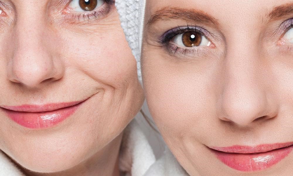 7 Benefits Of Using A High-Frequency Facial Machine