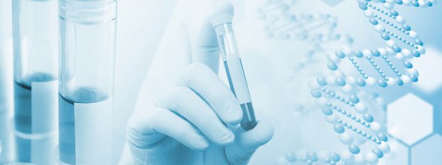 The Importance Of Reagent Preparation Systems - Blogging Hub