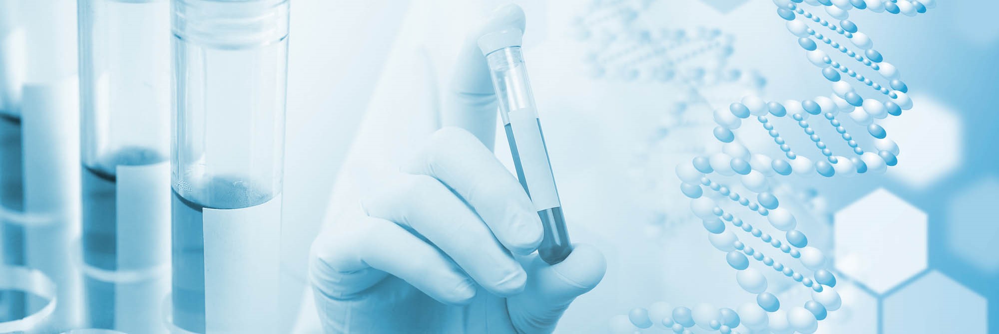 The Importance Of Reagent Preparation Systems - Blogging Hub